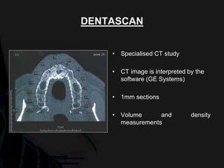 Advanced Implant Surgical Procedures.ppt