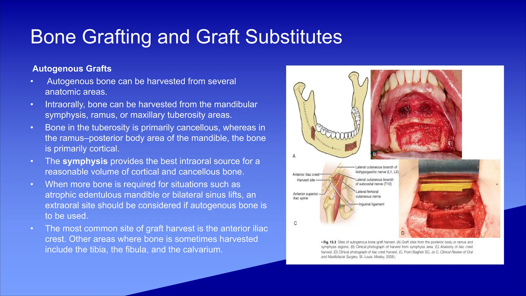 Contemporary Oral and Maxillofacial Surgery : Advanced Implant ...