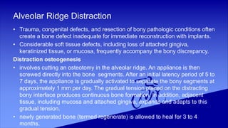 Contemporary Oral and Maxillofacial Surgery : Advanced Implant ...