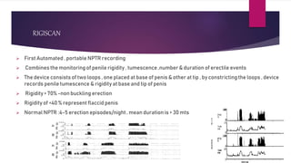 ADVANCED METHODS OF ERECTILE DYSFUNCTION.pptx