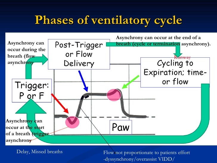 Advanced modes of Mechanical Ventilation-Do we need them?