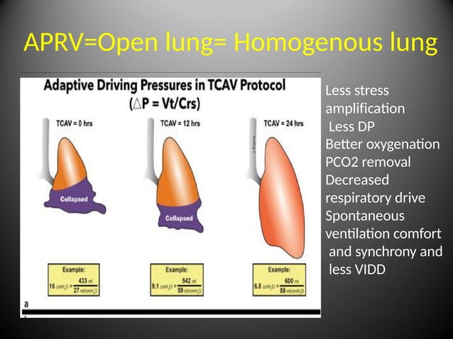 Advanced MODES of ventilation Module 1 TRC copy.pptx