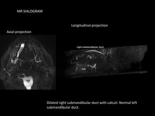 MRI in neck imaging | PPT
