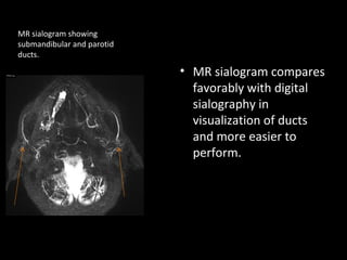 MRI in neck imaging | PPT