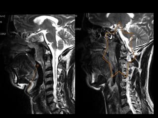 MRI in neck imaging | PPT