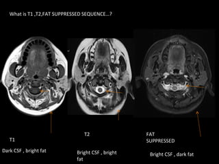 MRI in neck imaging | PPT