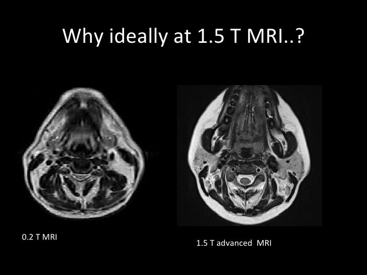 MRI in neck imaging