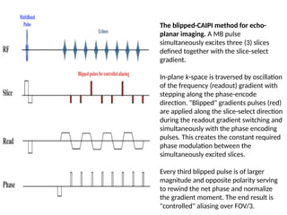 Recent advancements in MRI Sequences.pptx