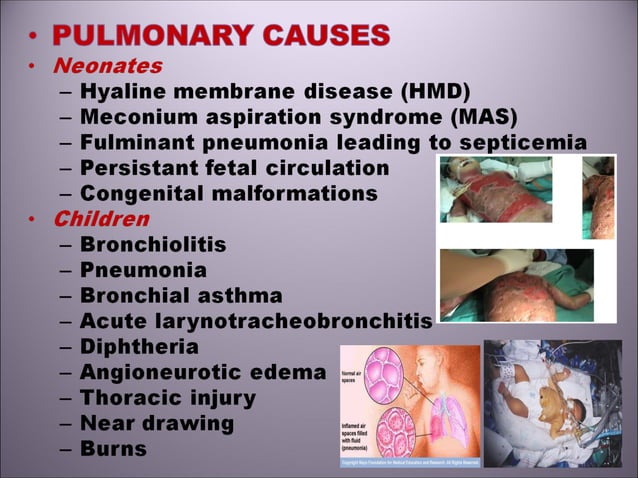 Advanced neonatal procedures | PPT | Lung and Respiratory Health ...