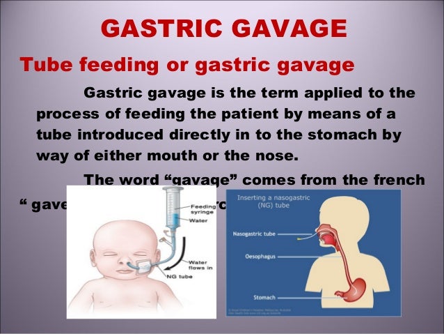 Gastric Lavage