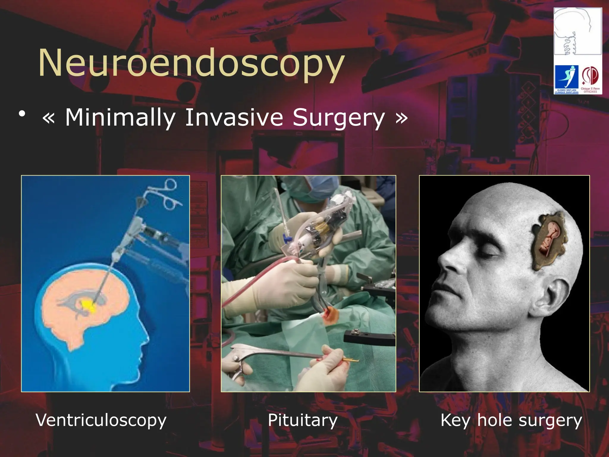advancedneuro2006-160305135258sjdbsa.kdcbas.kbc.pptx