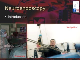 Advanced Neuro Endoscopy | PDF