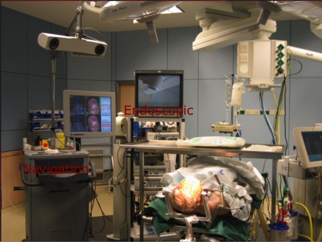 Advanced Neuro Endoscopy