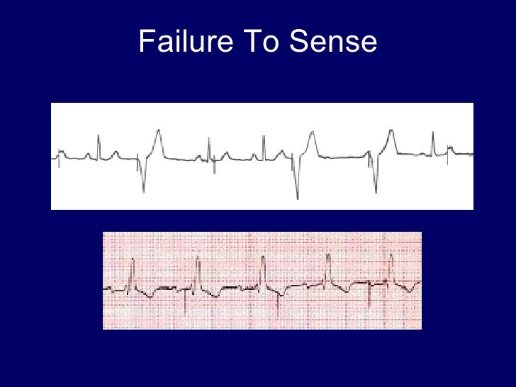 A D V A N C E D P A C I N G