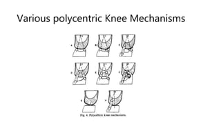 Advanced prosthetic knee joint | PPTX