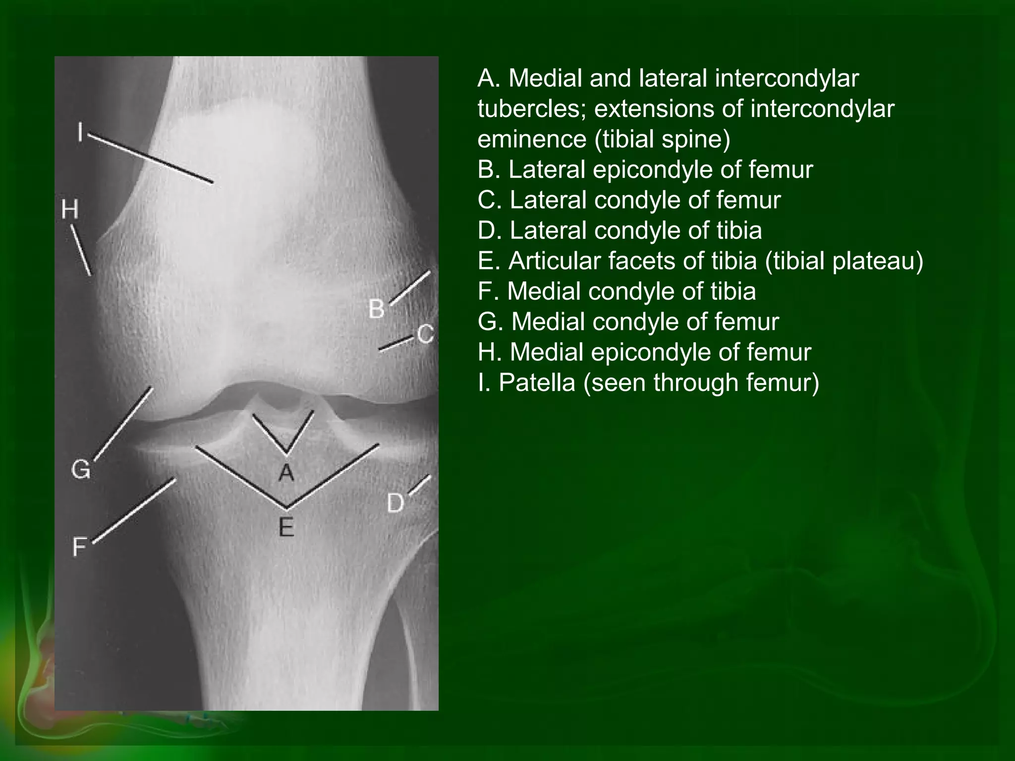 Advanced radiographic positions for the lower extremities | PPT