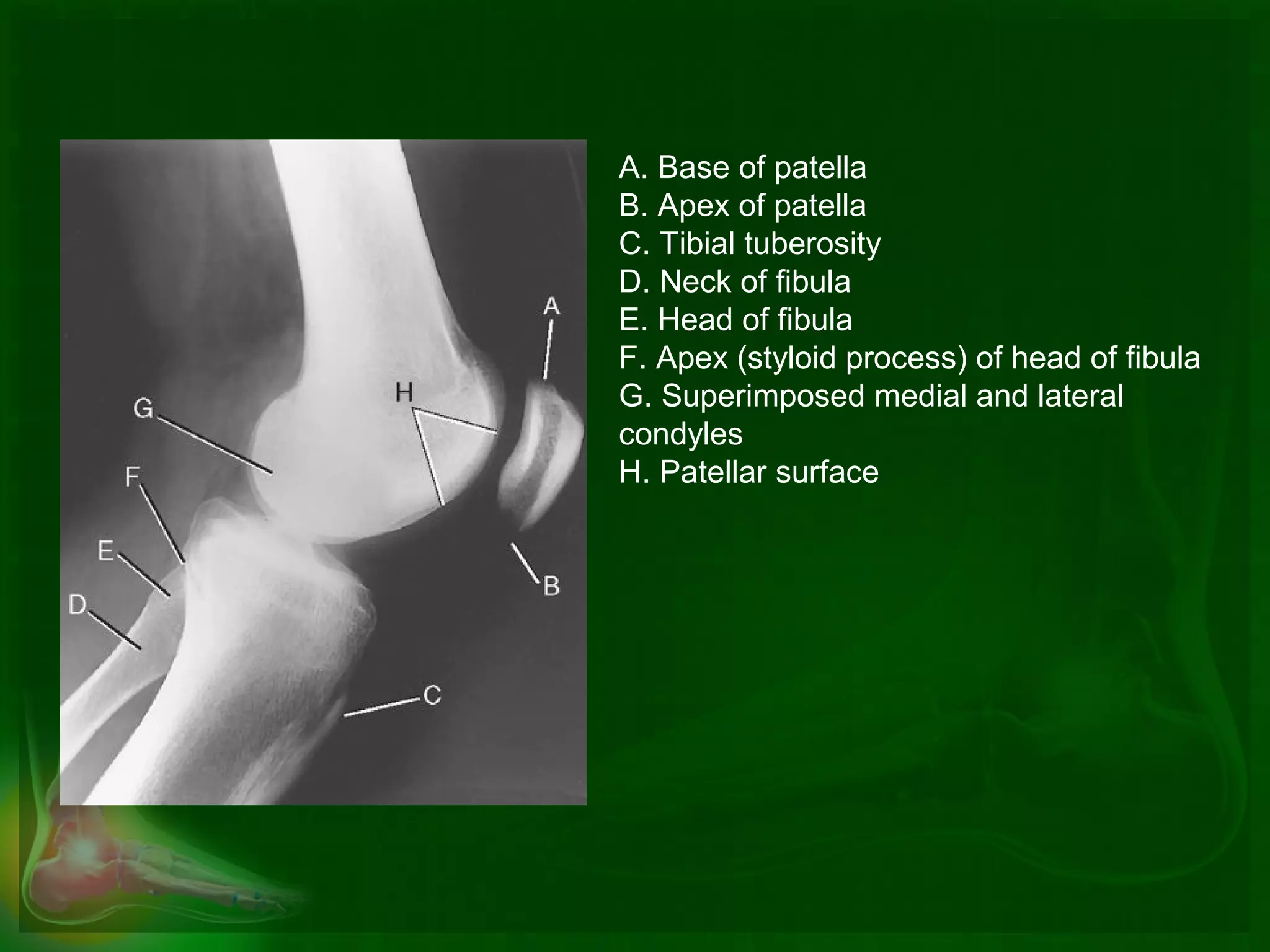 Advanced radiographic positions for the lower extremities | PPT