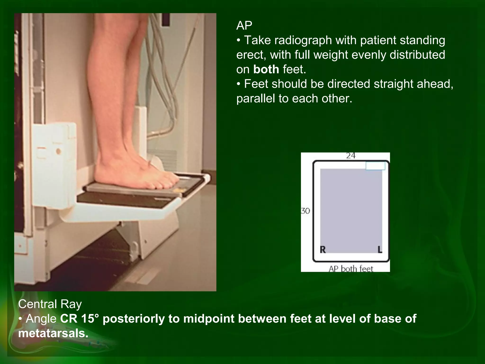 Advanced radiographic positions for the lower extremities | PPT