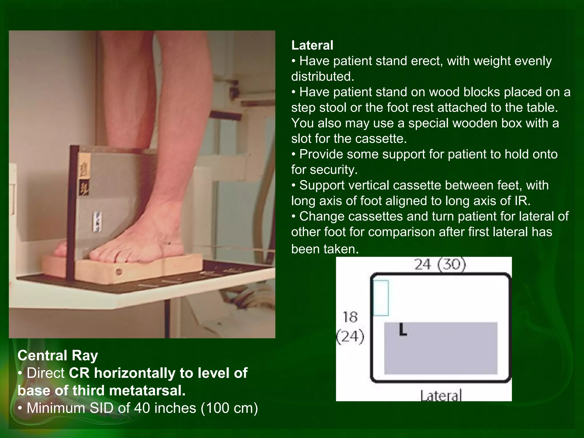 Advanced radiographic positions for the lower extremities | PPT