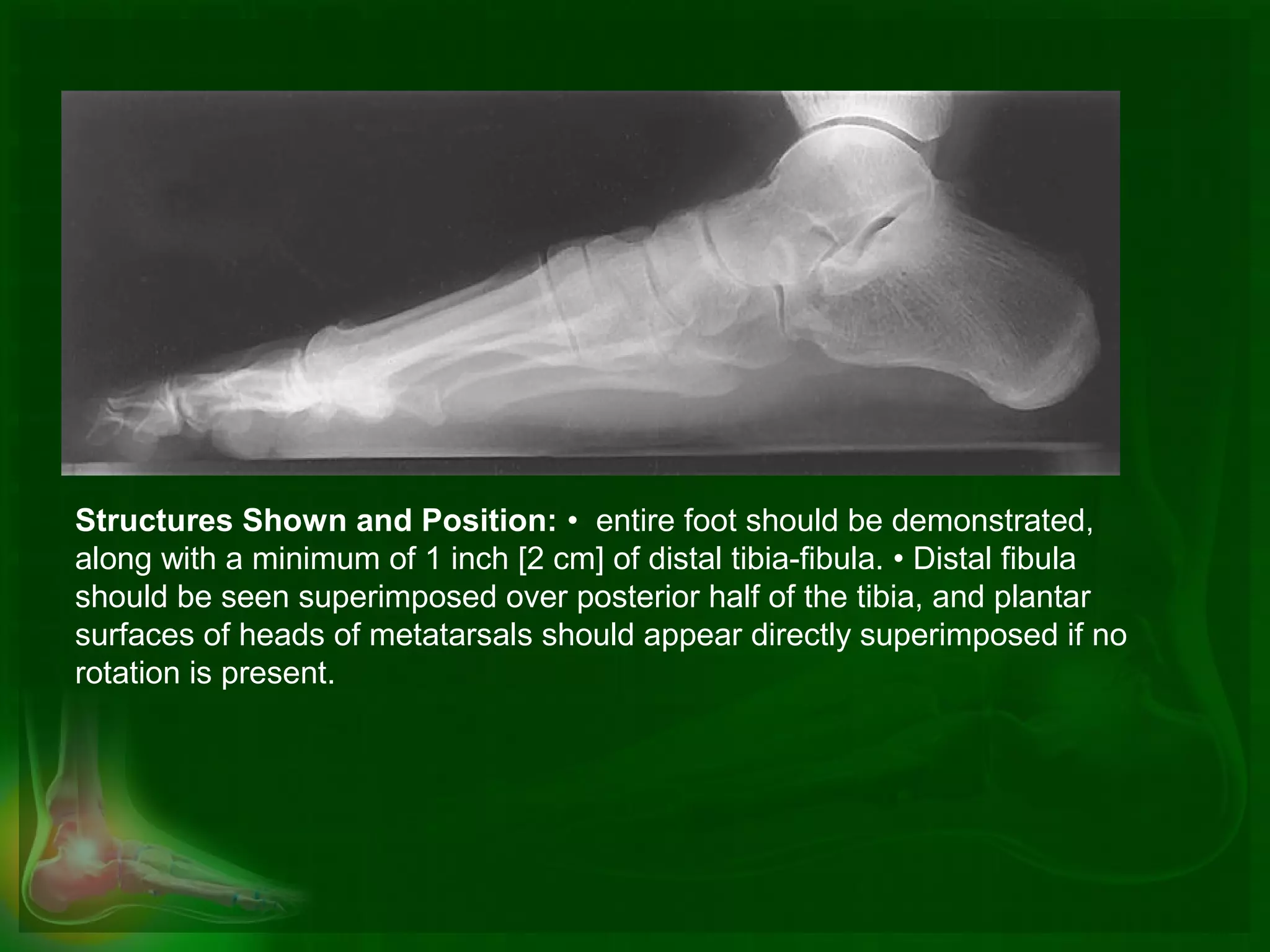 Advanced radiographic positions for the lower extremities | PPT