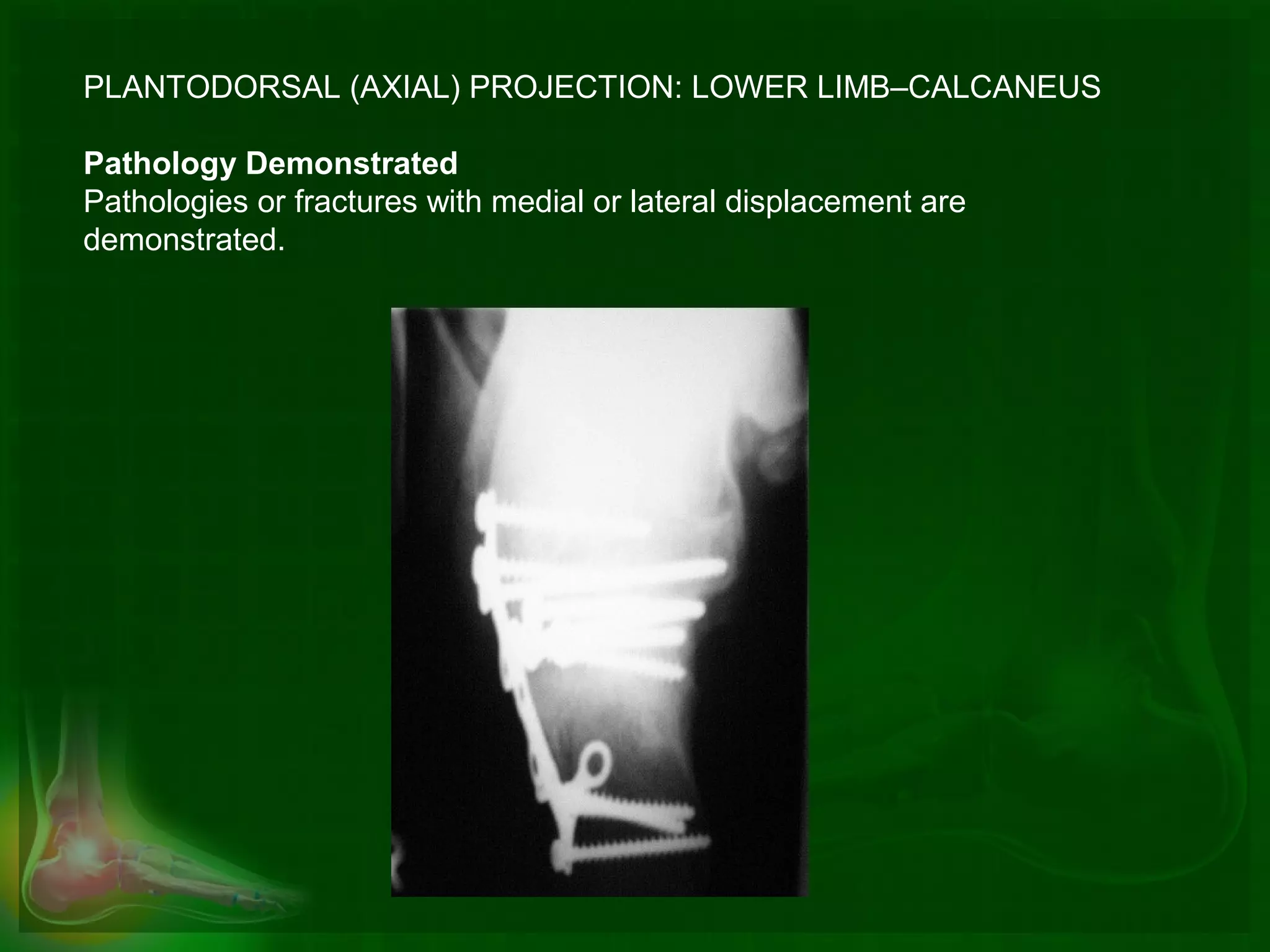 Advanced radiographic positions for the lower extremities | PPT