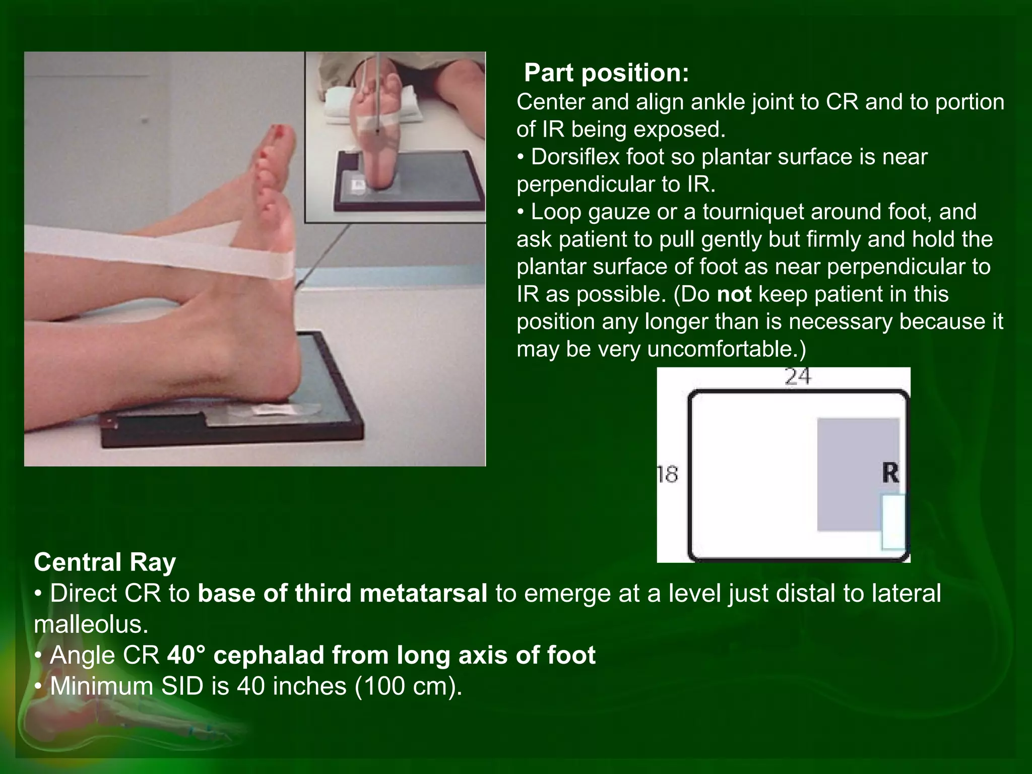 Advanced radiographic positions for the lower extremities | PPT