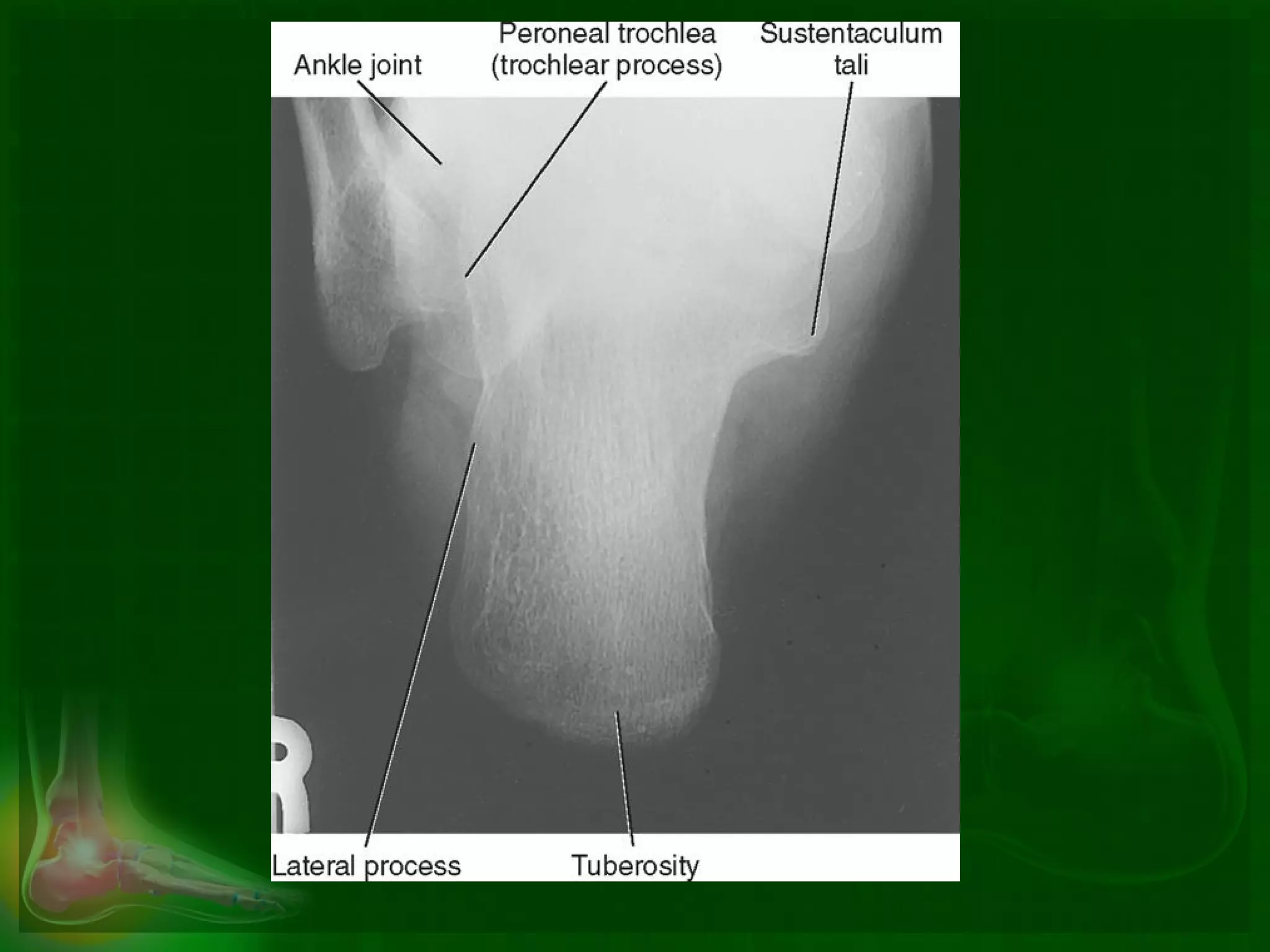 Advanced radiographic positions for the lower extremities | PPT