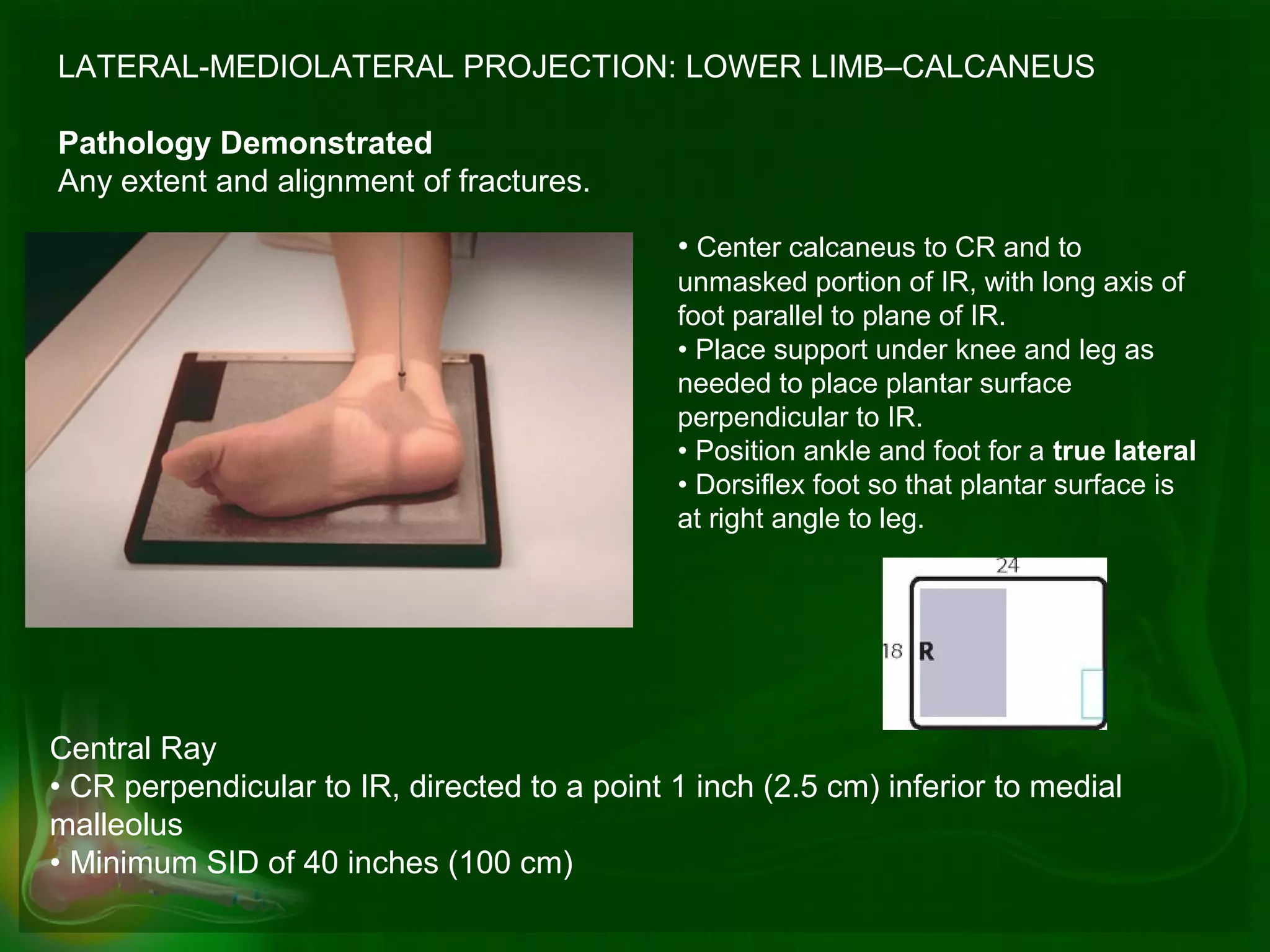 Advanced radiographic positions for the lower extremities | PPT