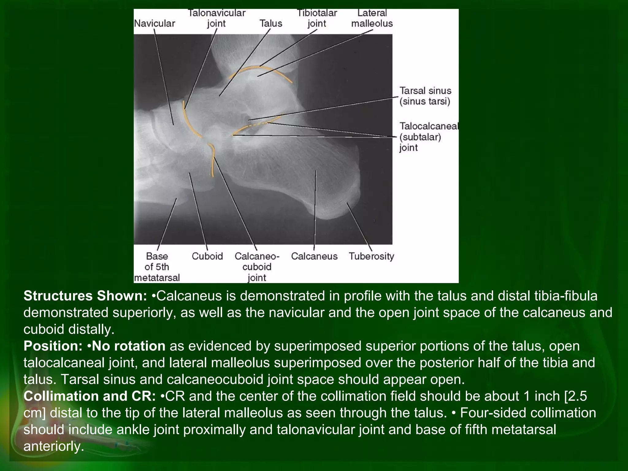 Advanced radiographic positions for the lower extremities | PPT