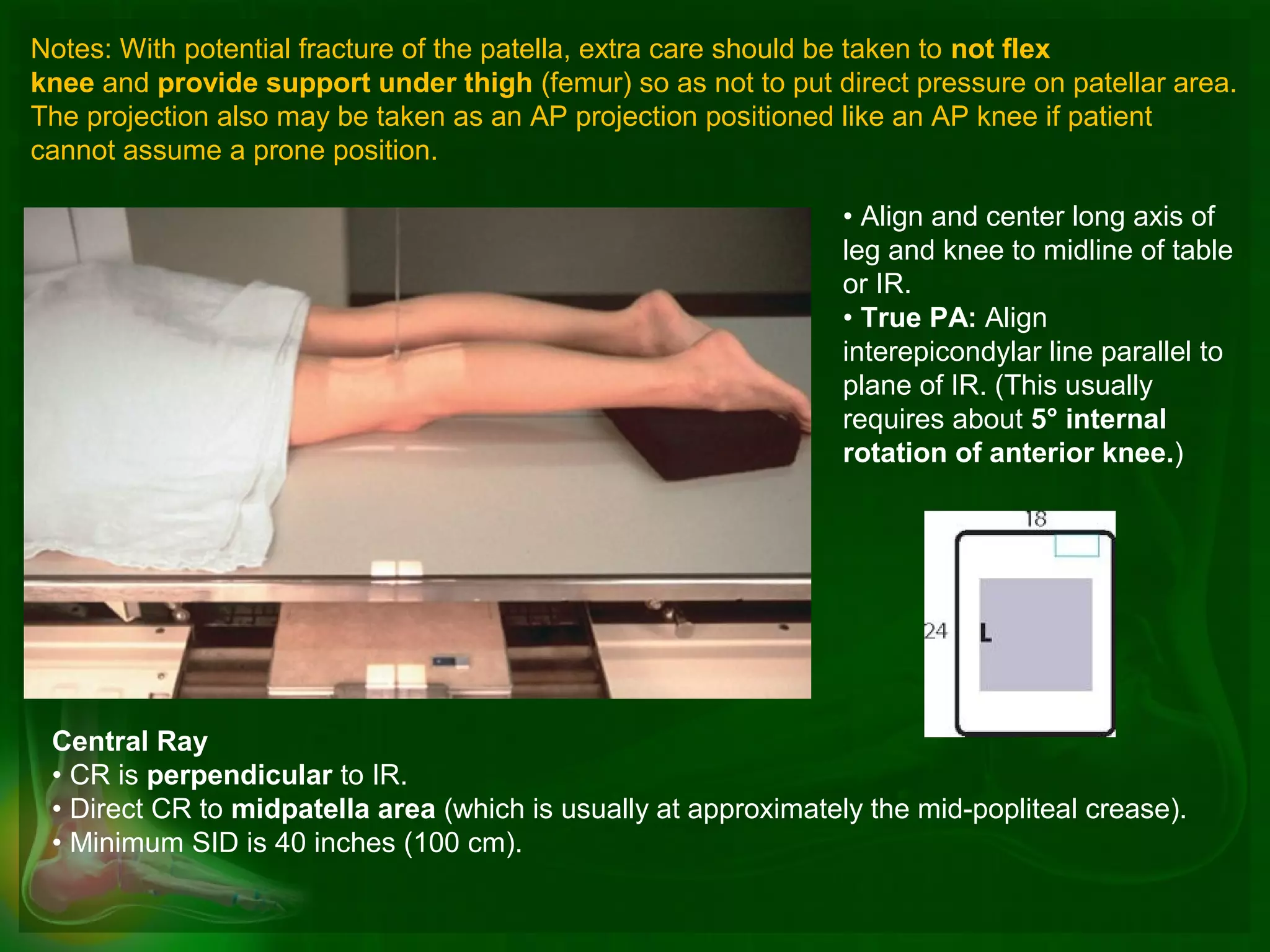 Advanced radiographic positions for the lower extremities | PPT