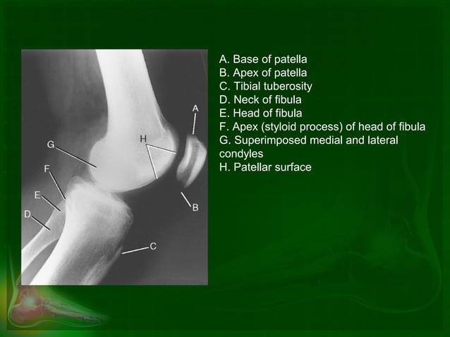 Advanced radiographic positions for the lower extremities | PPT