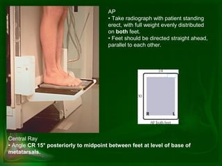 Advanced radiographic positions for the lower extremities | PPT