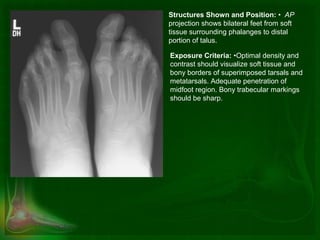 Advanced radiographic positions for the lower extremities | PPT