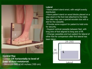 Advanced radiographic positions for the lower extremities | PPT