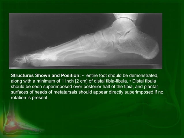Advanced radiographic positions for the lower extremities | PPT