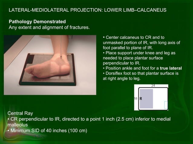 Advanced radiographic positions for the lower extremities | PPT