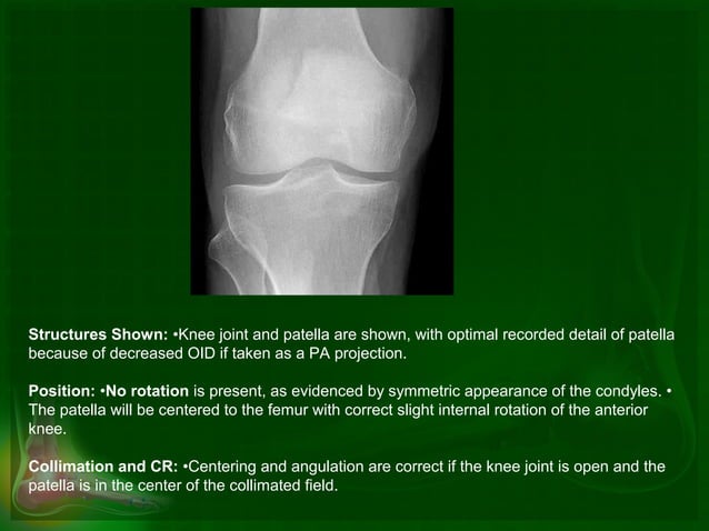 Advanced radiographic positions for the lower extremities | PPT
