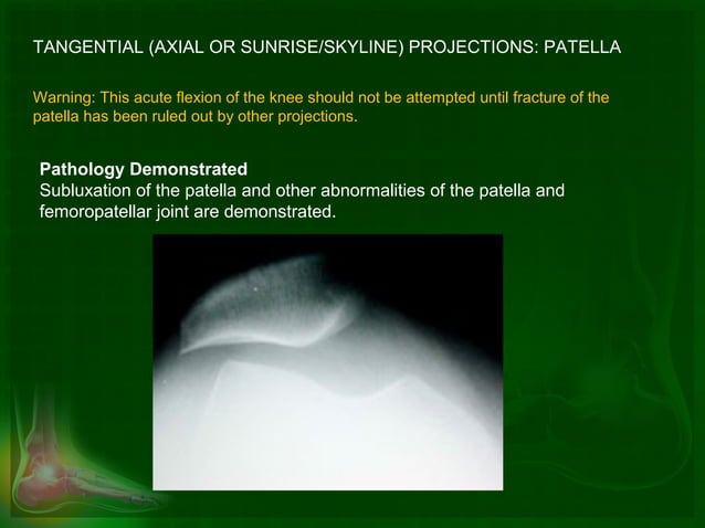 Advanced radiographic positions for the lower extremities | PPT