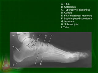Advanced radiographic positions for the lower extremities | PPT