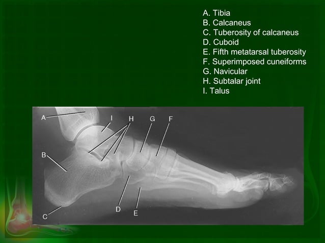 Advanced radiographic positions for the lower extremities | PPT