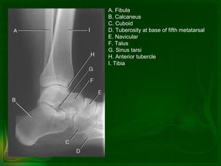 Advanced radiographic positions for the lower extremities | PPT