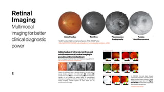 Advanced Retinal Imaging | PDF