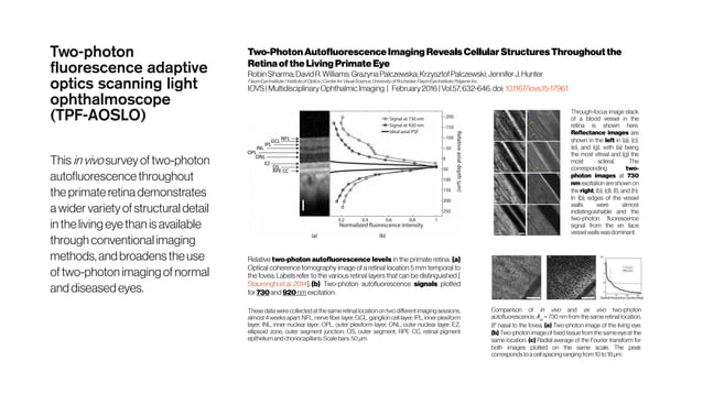 Advanced Retinal Imaging | PDF Advanced Retinal Imaging | PDF