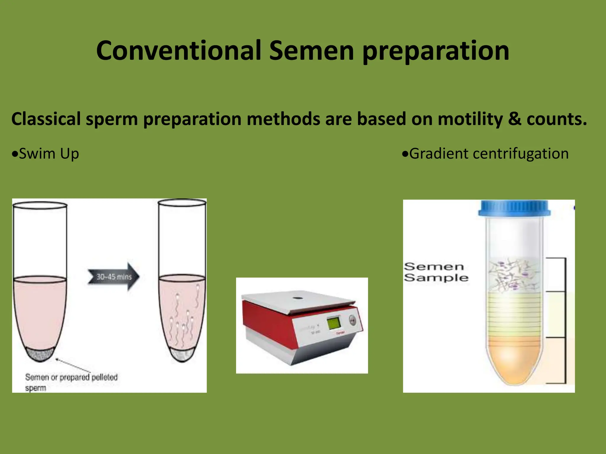 ADVANCED SPERM PREPARATION TECHNIQUES.pptx