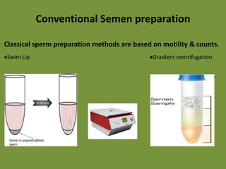 ADVANCED SPERM PREPARATION TECHNIQUES.pptx