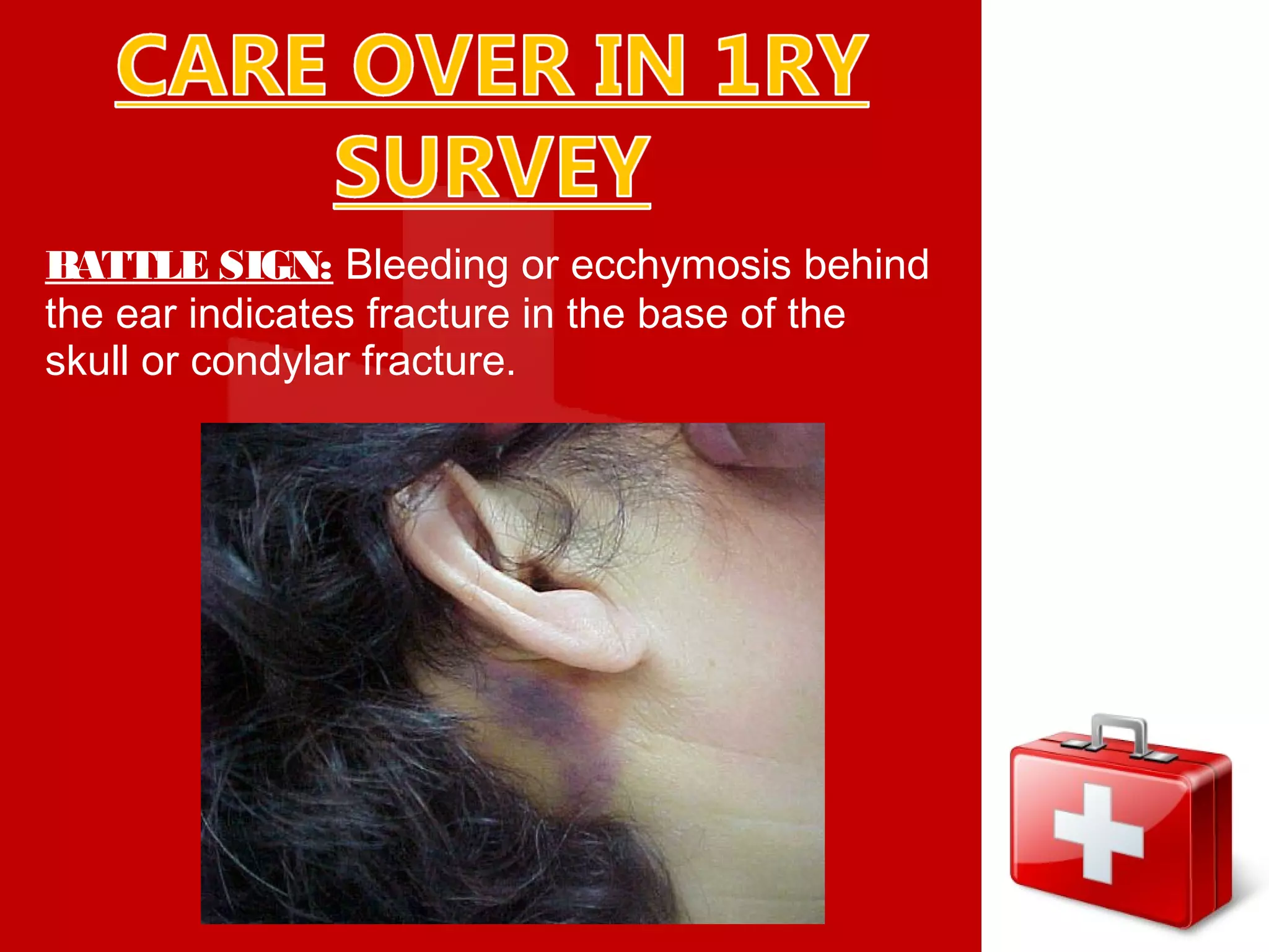 Advanced trauma life support (atls) | PPT