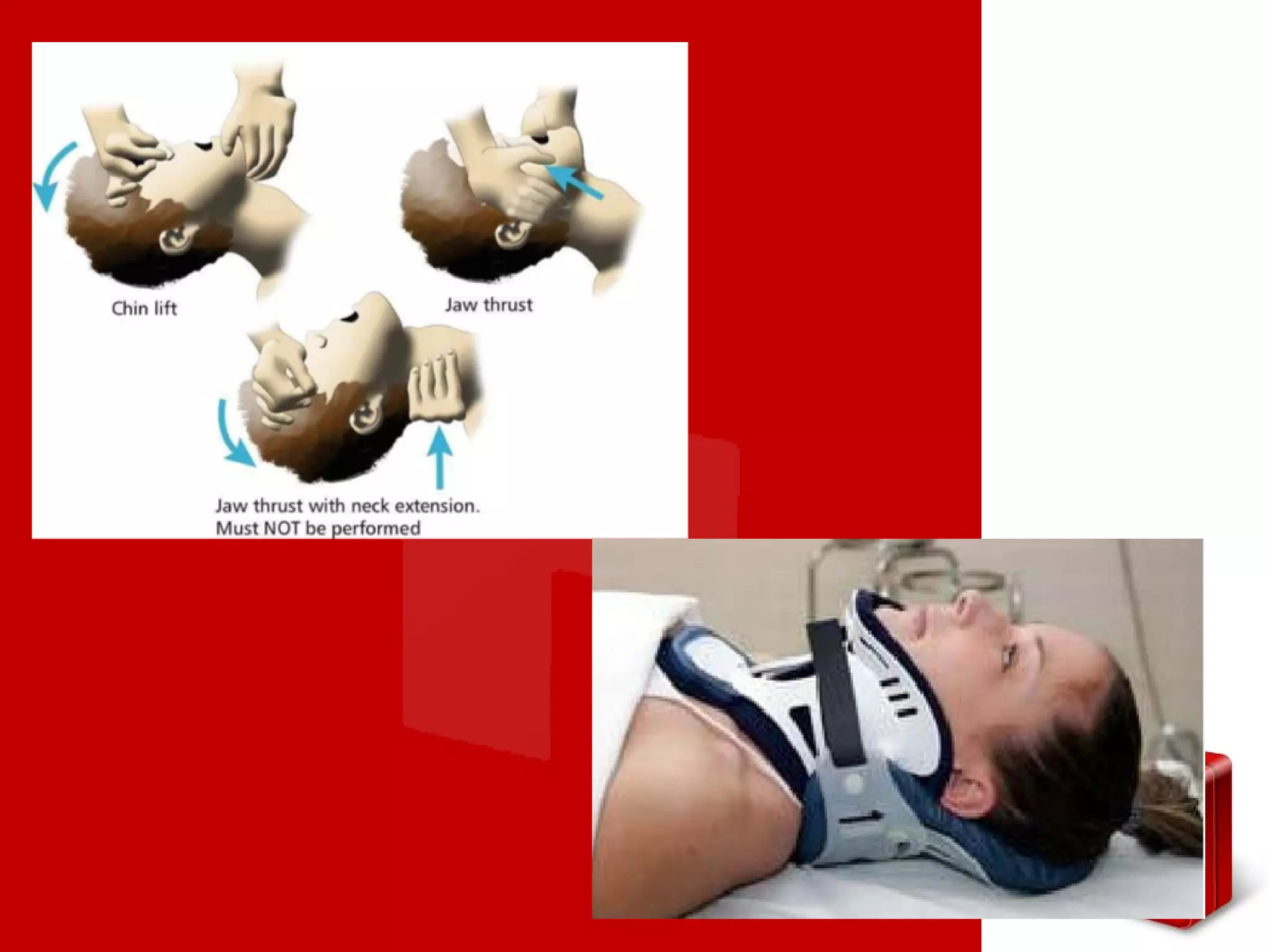 Advanced trauma life support (atls) | PPT