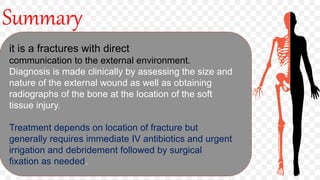 Advanced Treatment of Open Fractures by Habeeb Almajidi.pptx