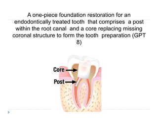 Advanced treatment of post & core - A presentation | PPTX