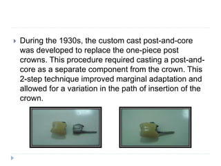 Advanced treatment of post & core - A presentation | PPTX
